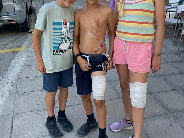 Επίθεση αγέλης σκύλων σε οικογένεια τουριστών – Τραυματίστηκαν δύο ...