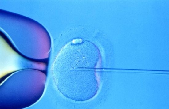 Βρετανία: Πρώτες γεννήσεις βρεφών με DNA από τρεις ανθρώπους | zarpanews.gr